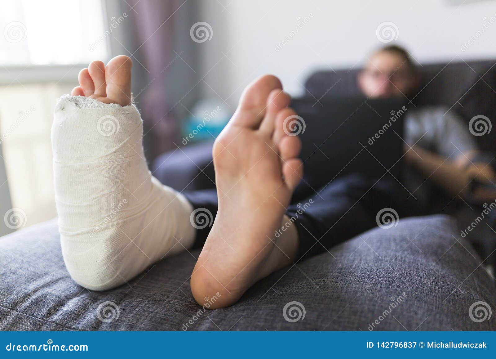 Home Convalescence after Breaking the Right Leg Stock Image - Image of ...