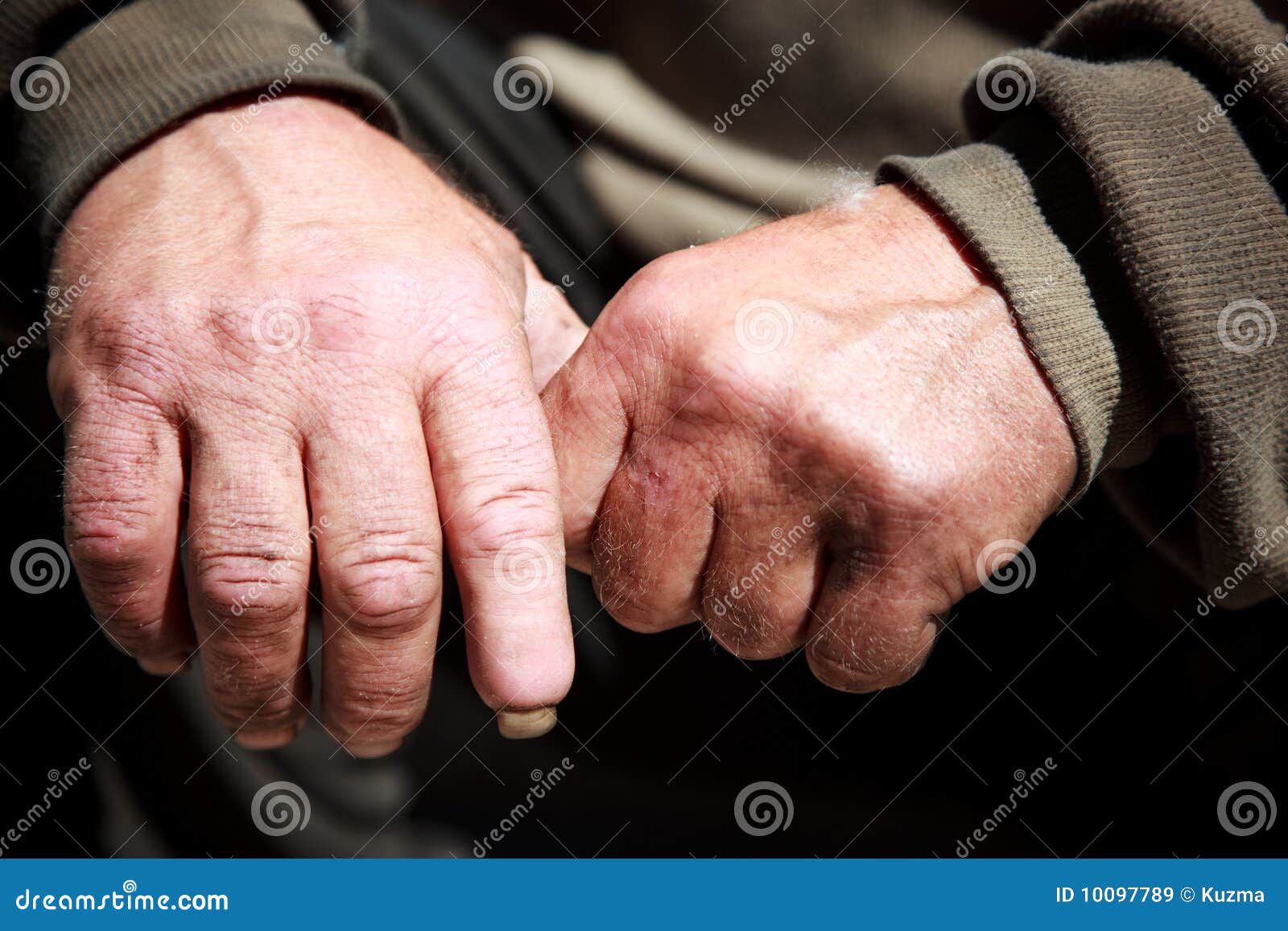 Homeless hands stock image. Image of unhygienic, vagrant - 10097789