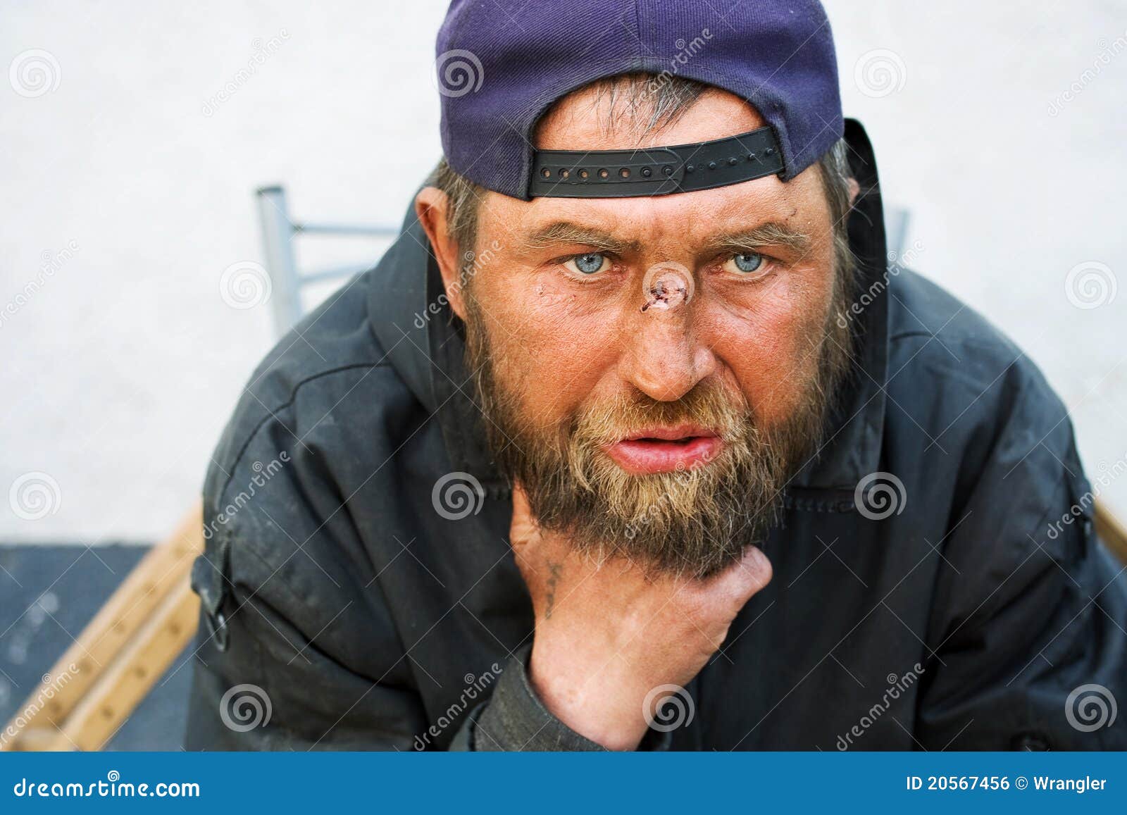 Homeless man stock photo. Image of illness, face, beggar - 20567456