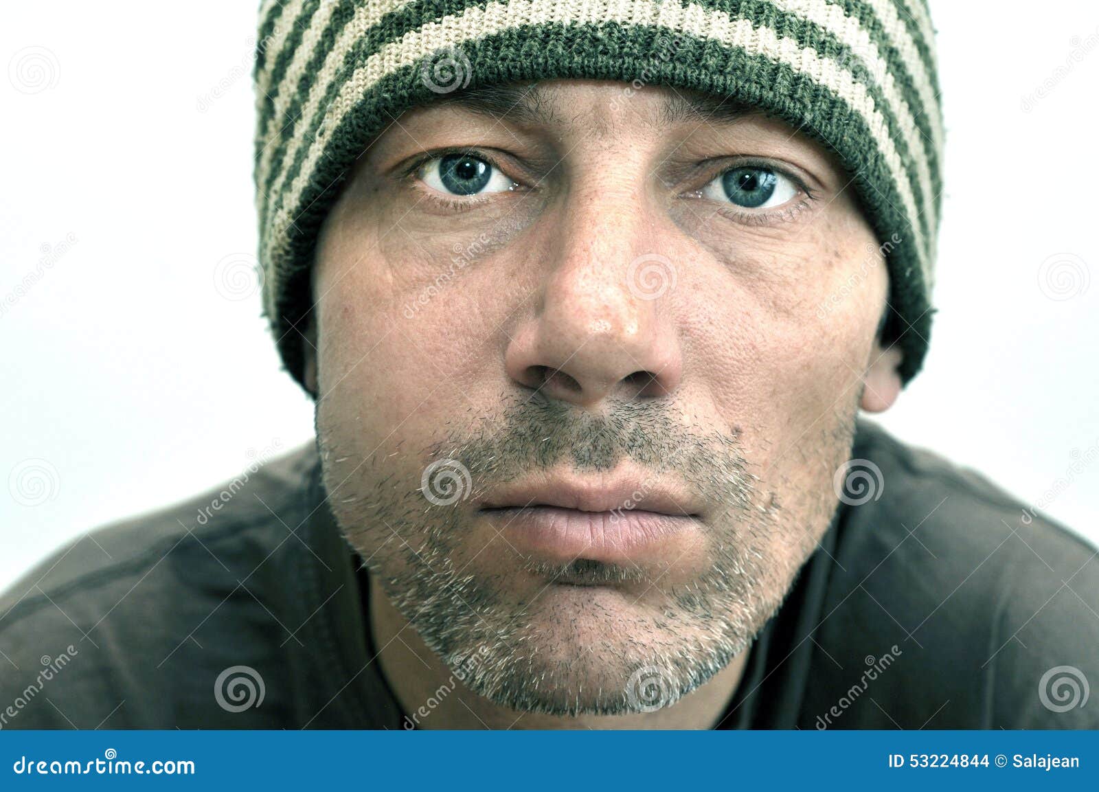 Homem Com a Cara Inchada Que Sofre Da Dor De Dente Foto de Stock ...
