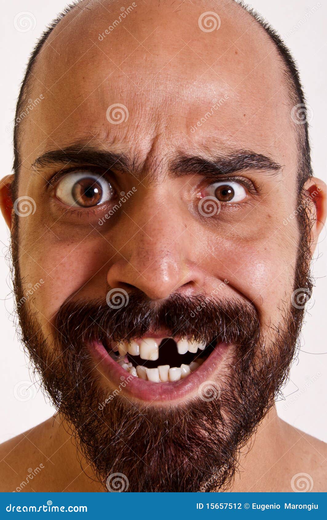 Homem Engraçado Sem Um Dente Foto de Stock - Imagem de isolado, pessoa ...