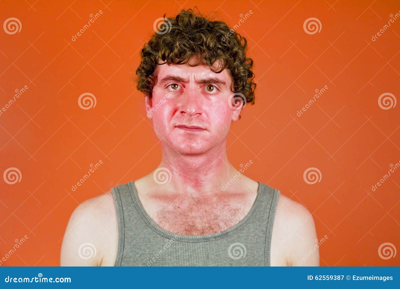 Homem suado queimado imagem de stock. Imagem de machucado - 62559387