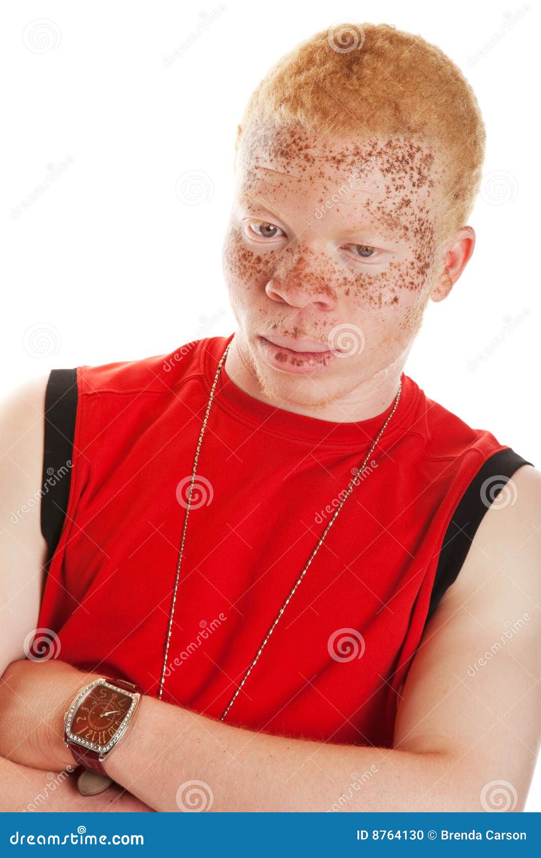 Homme albinos photo stock. Image du minorité, albinos - 8764130