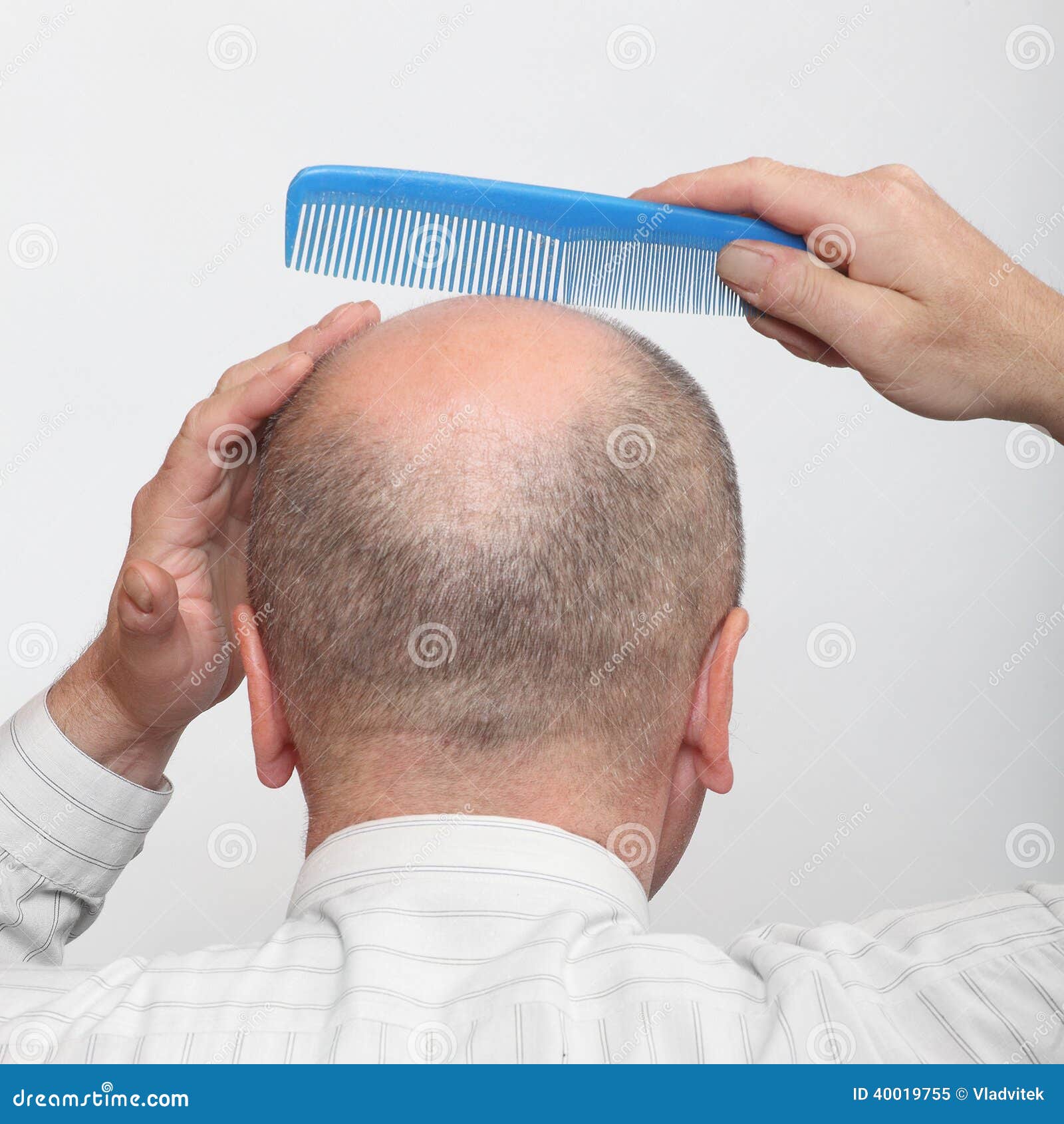 Homme chauve. image stock. Image du attrayant, forever - 40019755