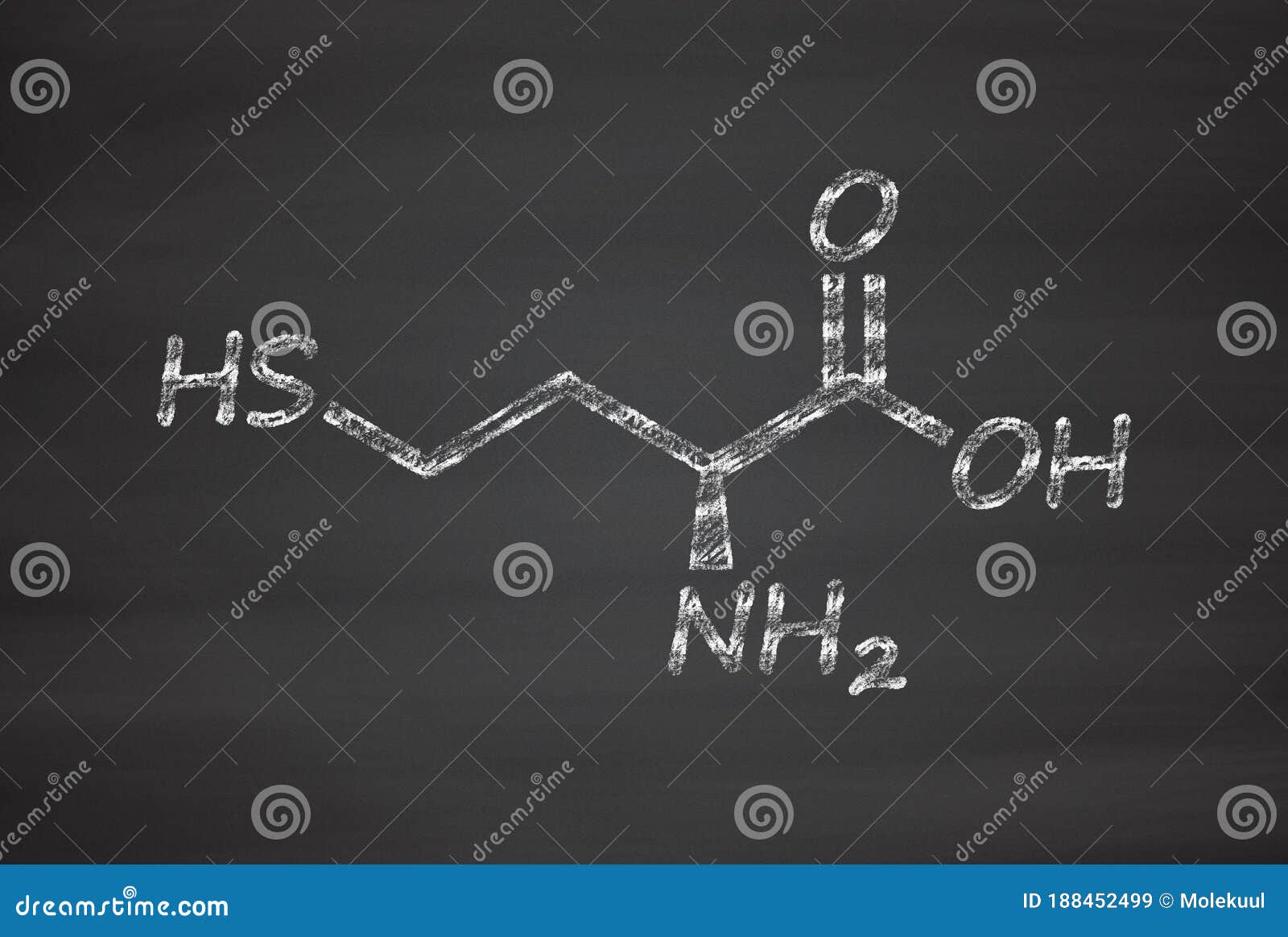 Homocysteine (Hcy) Biomarker Molecule. Increased Levels Indicate ... Homocysteine (Hcy) Biomarker Molecule. Increased Levels Indicate ...