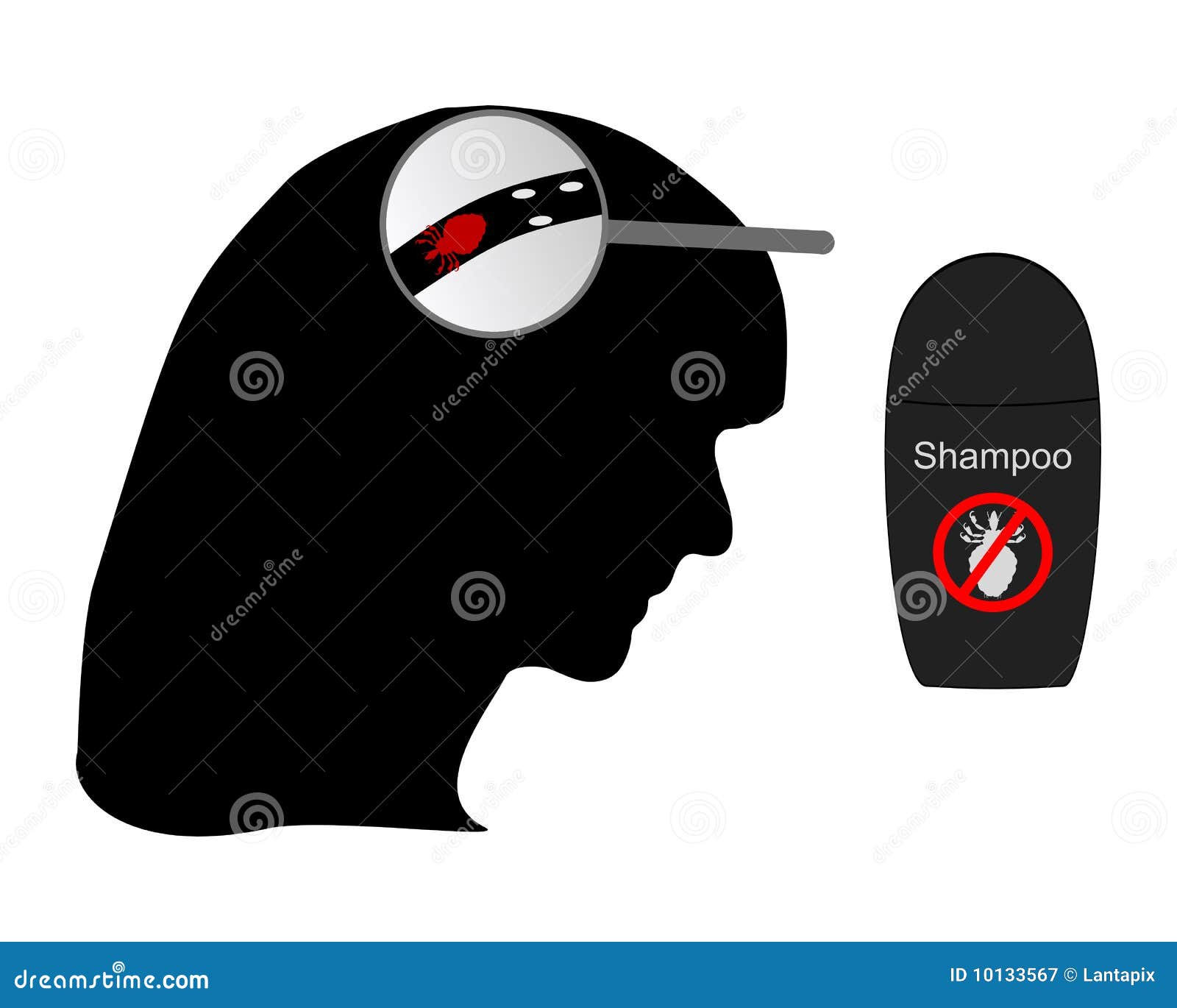 Hoofd Van Vrouw, Luis, Neet En Shampoo Vector Illustratie ...