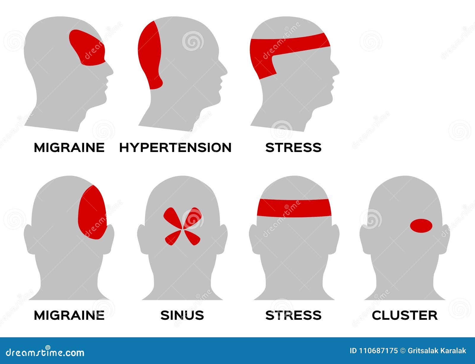 Hoofdpijntype/orgaan En Anatomieconcept Vector Illustratie ...