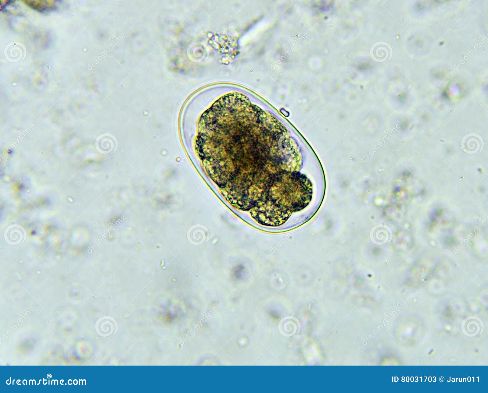 Hookworm Under Microscope