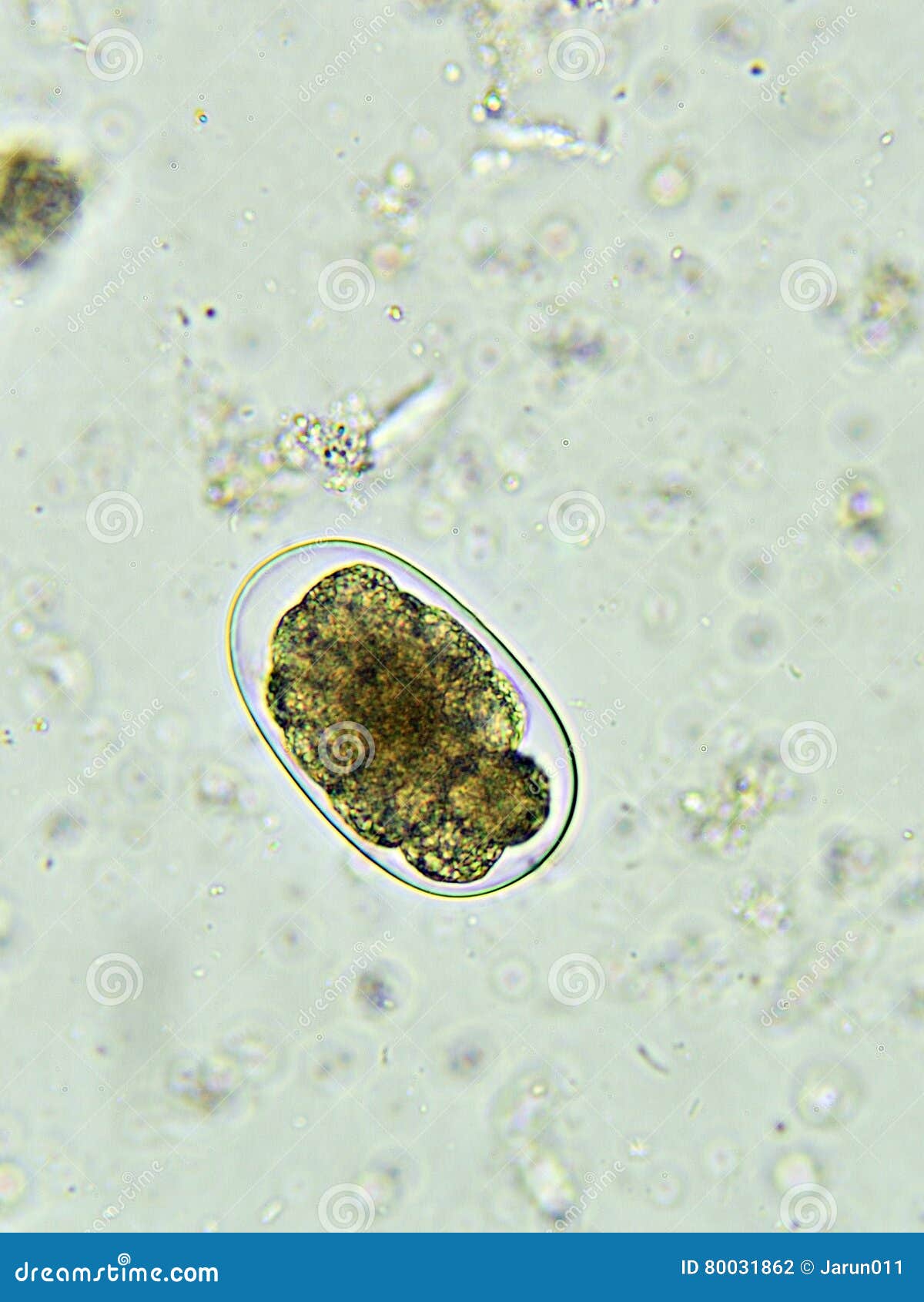 Hook worm stock photo. Image of experiment, diminuta - 80031862