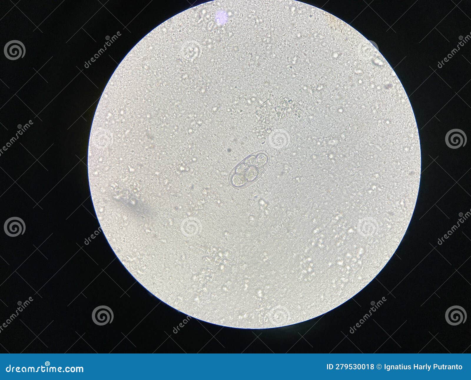 Hook Worm Eggs of Parasite in Stool Examination Stock Photo - Image of ...