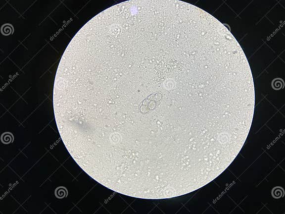 Hook Worm Eggs of Parasite in Stool Examination Stock Photo - Image of ...