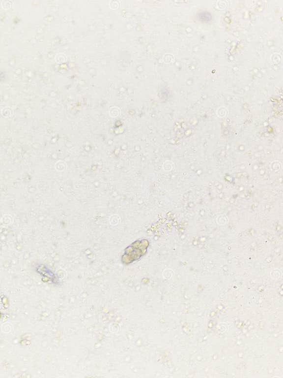 Hook Worm Eggs of Parasite in Stool Examination Stock Image - Image of ...