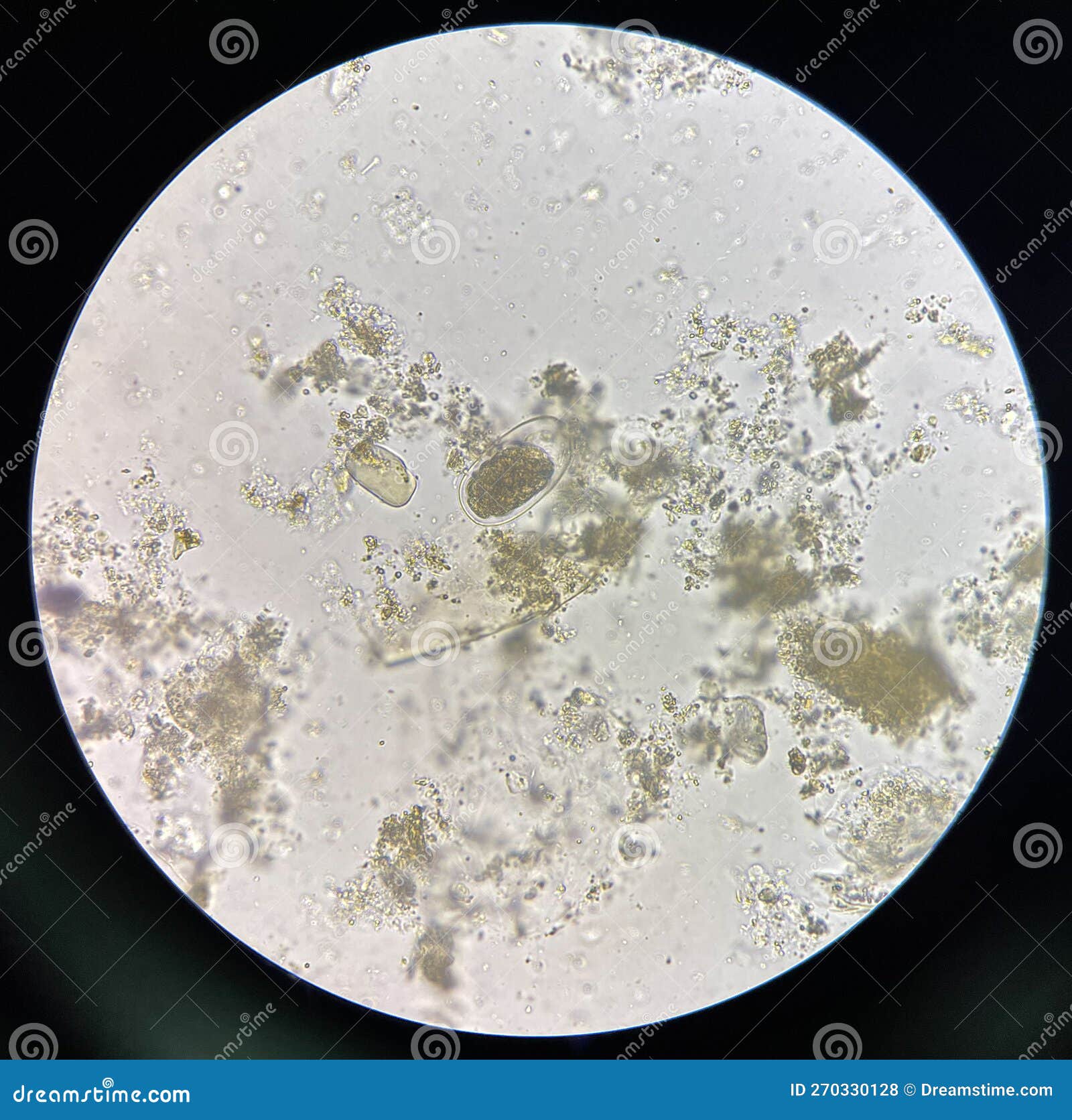 Hookworm Egg Human Parasite in Stool Examination Test Stock Photo ...