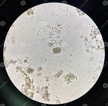 Hookworm Egg Human Parasite in Stool Examination Test Stock Photo ...