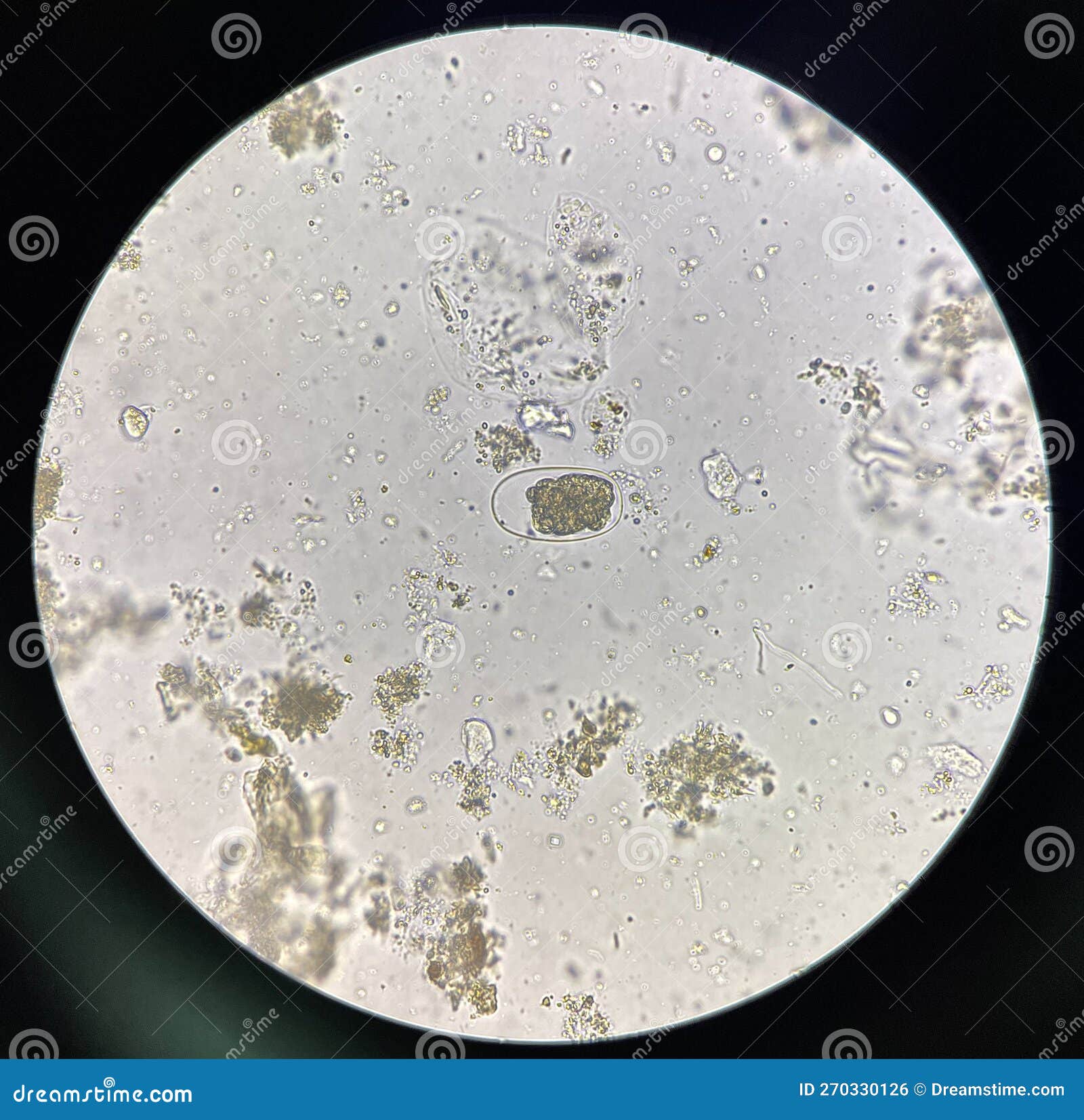 Hookworm Egg Human Parasite In Stool Examination Test Stock Photo ...