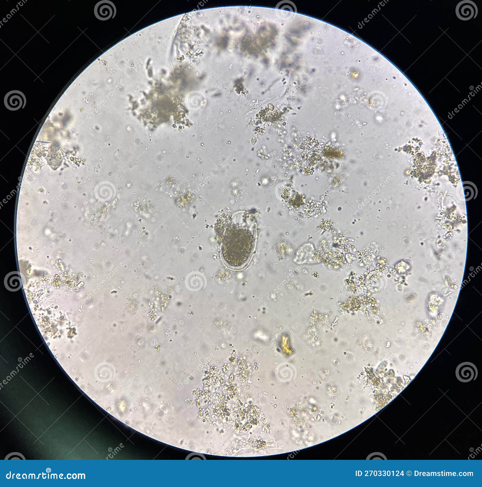Hookworm Egg Human Parasite in Stool Examination Test Stock Photo ...