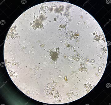 Hookworm Egg Human Parasite in Stool Examination Test Stock Photo ...