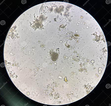 Hookworm Egg Human Parasite in Stool Examination Test Stock Photo ...