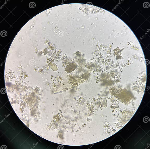 Hookworm Egg Human Parasite in Stool Examination Test Stock Photo ...