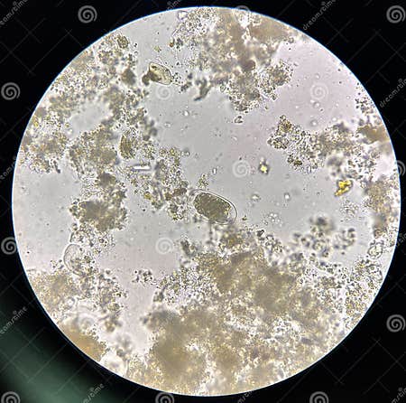 Hookworm Egg Human Parasite in Stool Examination Test Stock Photo ...