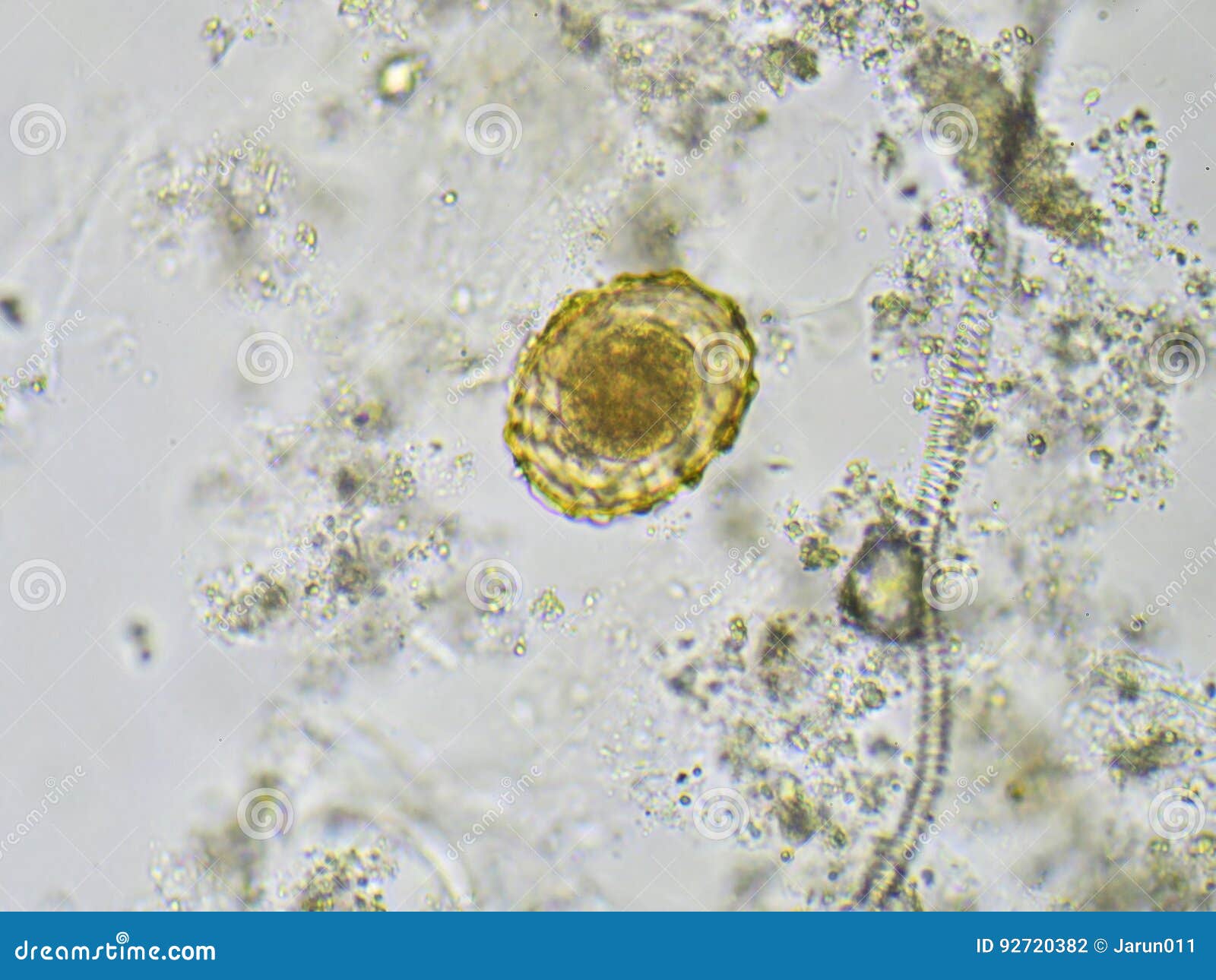 Hookworm stock photo. Image of organism, ancylostoma - 92720382