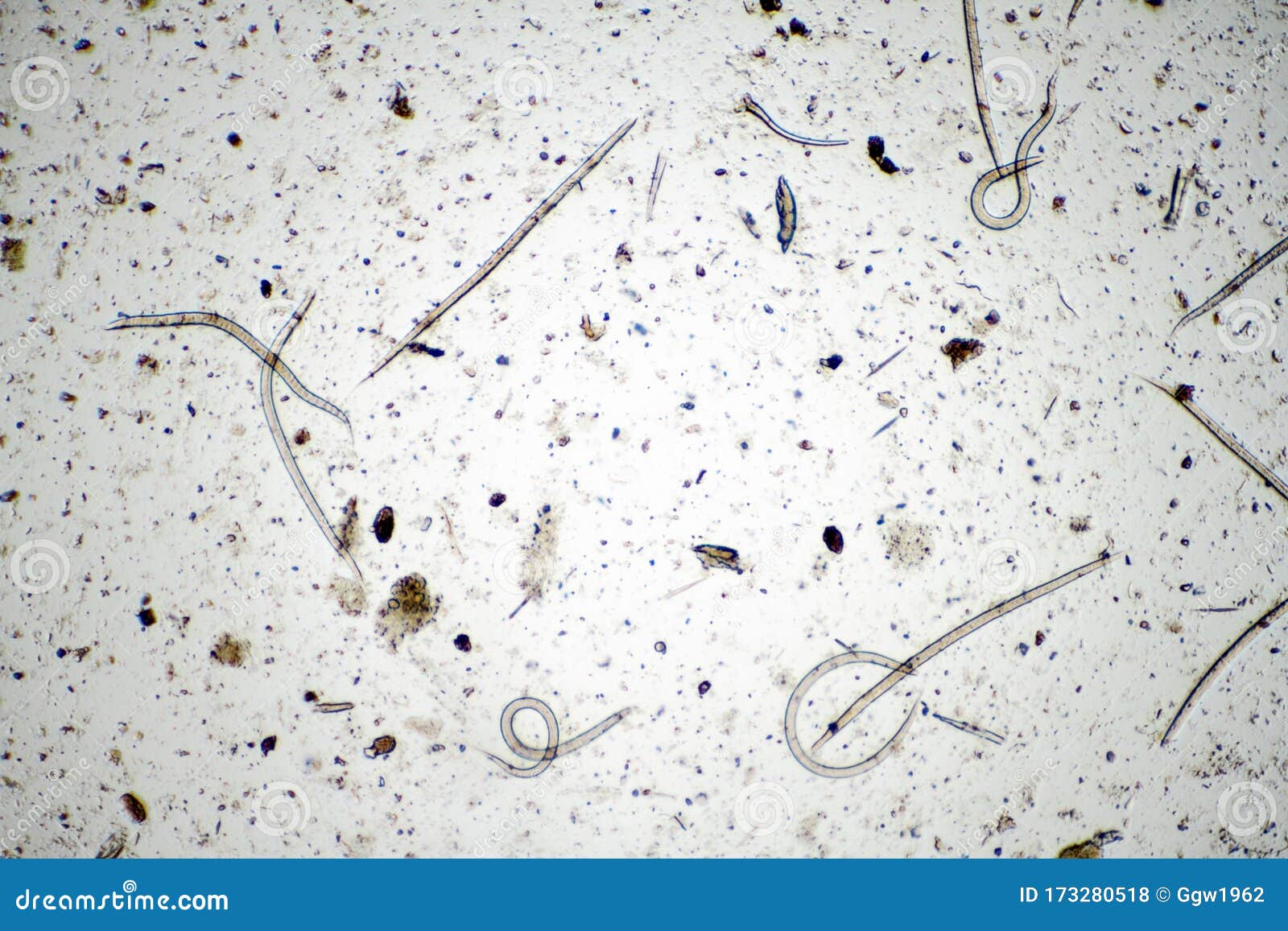 Hookworms stock photo. Image of nematode, sickness, parasite - 173280518