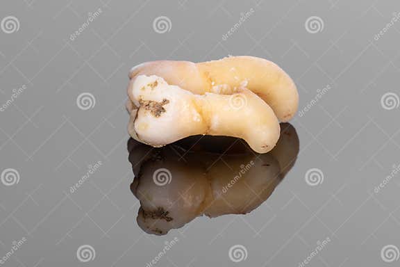 A Closeup of a Sectioning Right Lower Third Molar with Curved Root ...