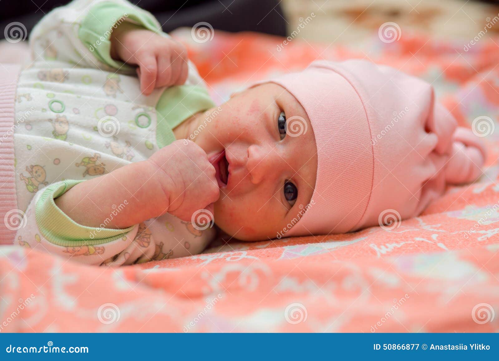 Hormonal rash in a newborn stock image. Image of born - 50866877