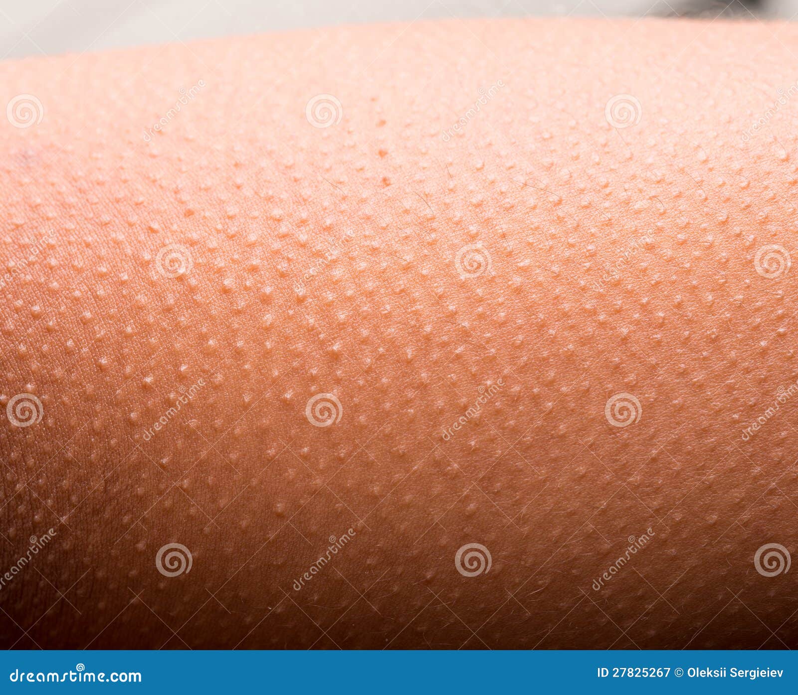 Horripilation stock image. Image of reflex, flesh, female - 27825267