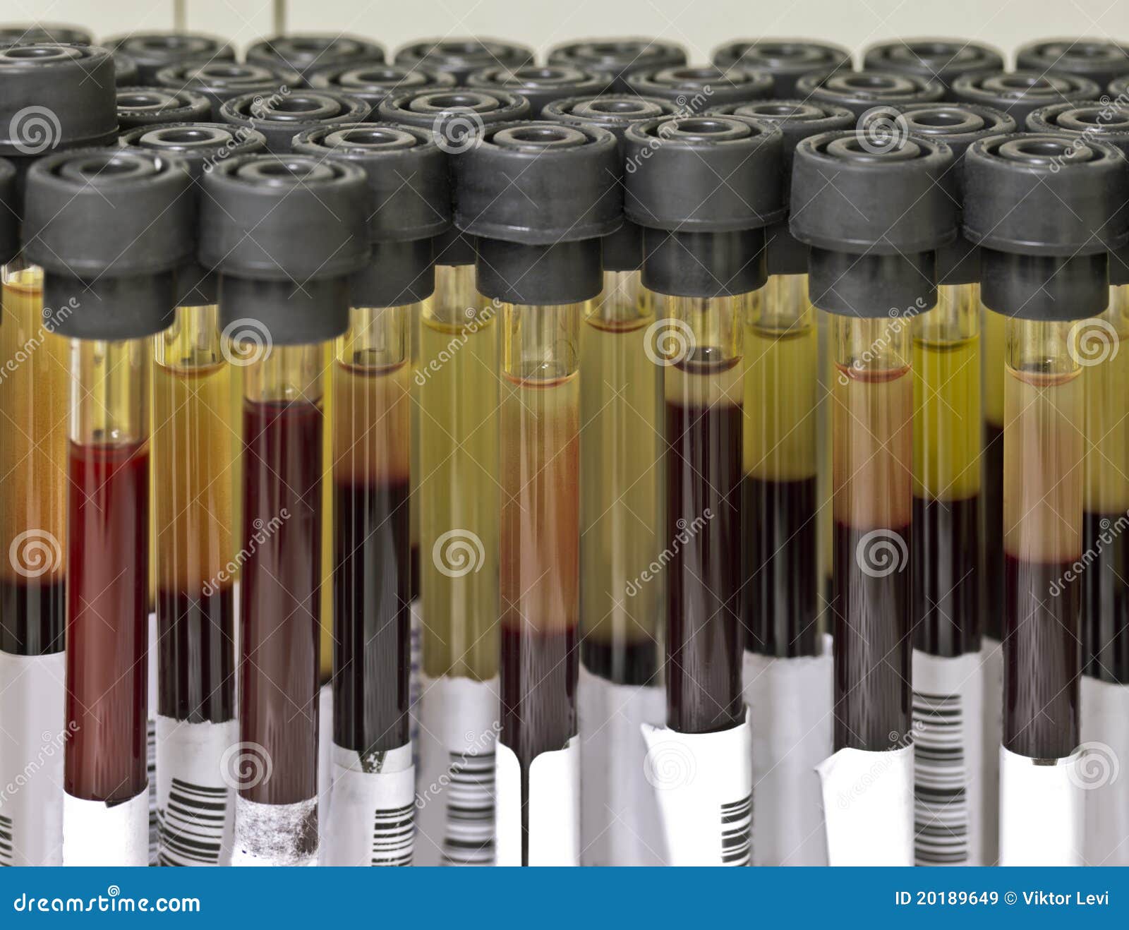 Hospital blood test tubes stock image. Image of healthcare - 20189649