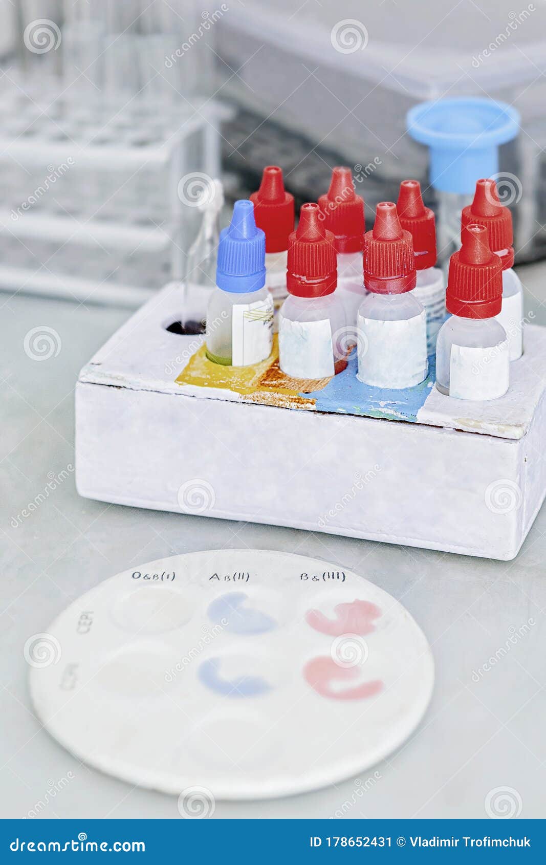 Hospital, Chemistry Lab, Blood Sample Cup Stock Image - Image of ...