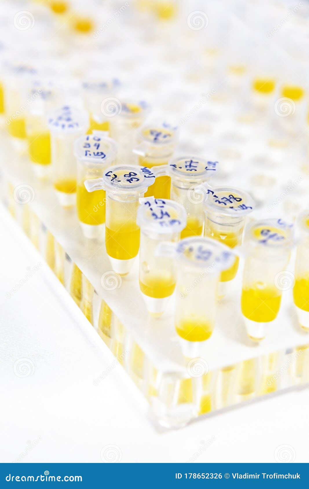 Hospital, Chemistry Lab, Sample Analysis Stock Photo - Image of ...