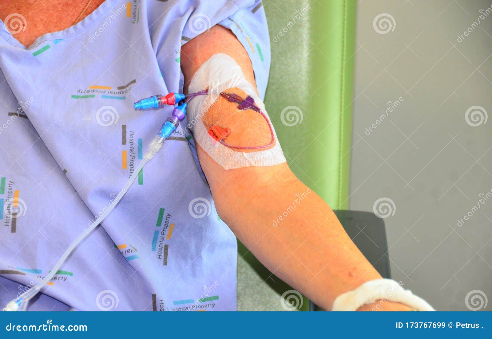 Medical Intravenous System Stock Photo | CartoonDealer.com #33588996 Medical Intravenous System Stock Photo | CartoonDealer.com #33588996