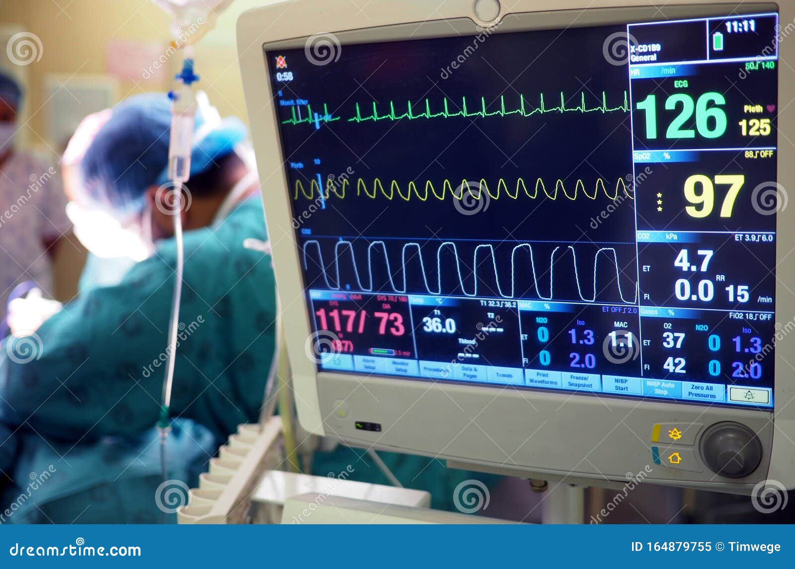 Hospital Operating Theatre with ECG Machine Stock Image - Image of ...