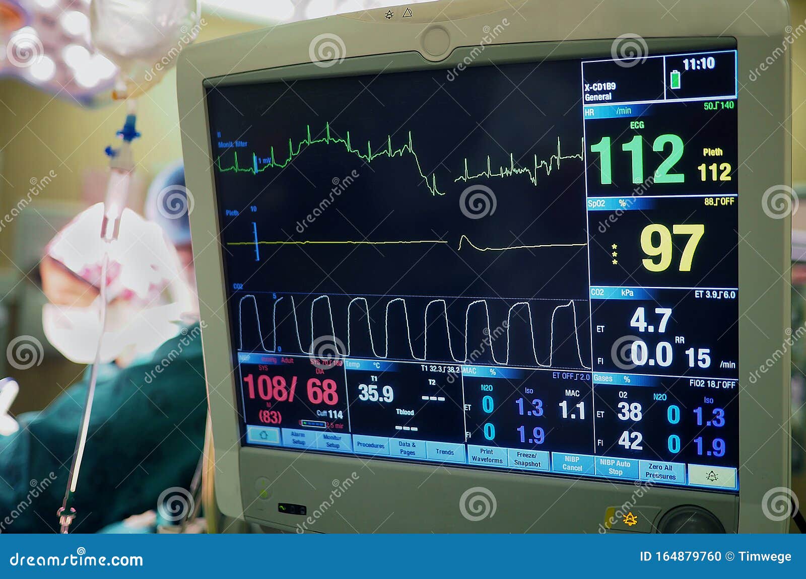 Hospital Operating Theatre with ECG Machine Stock Photo - Image of ...