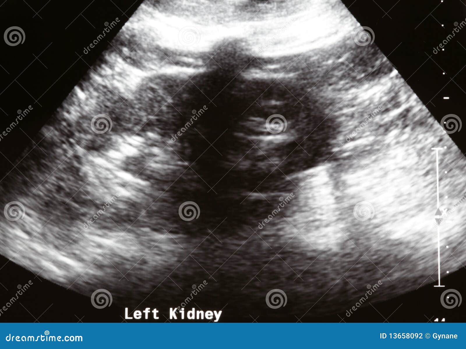 Hospital scan stock photo. Image of sonography, macro - 13658092