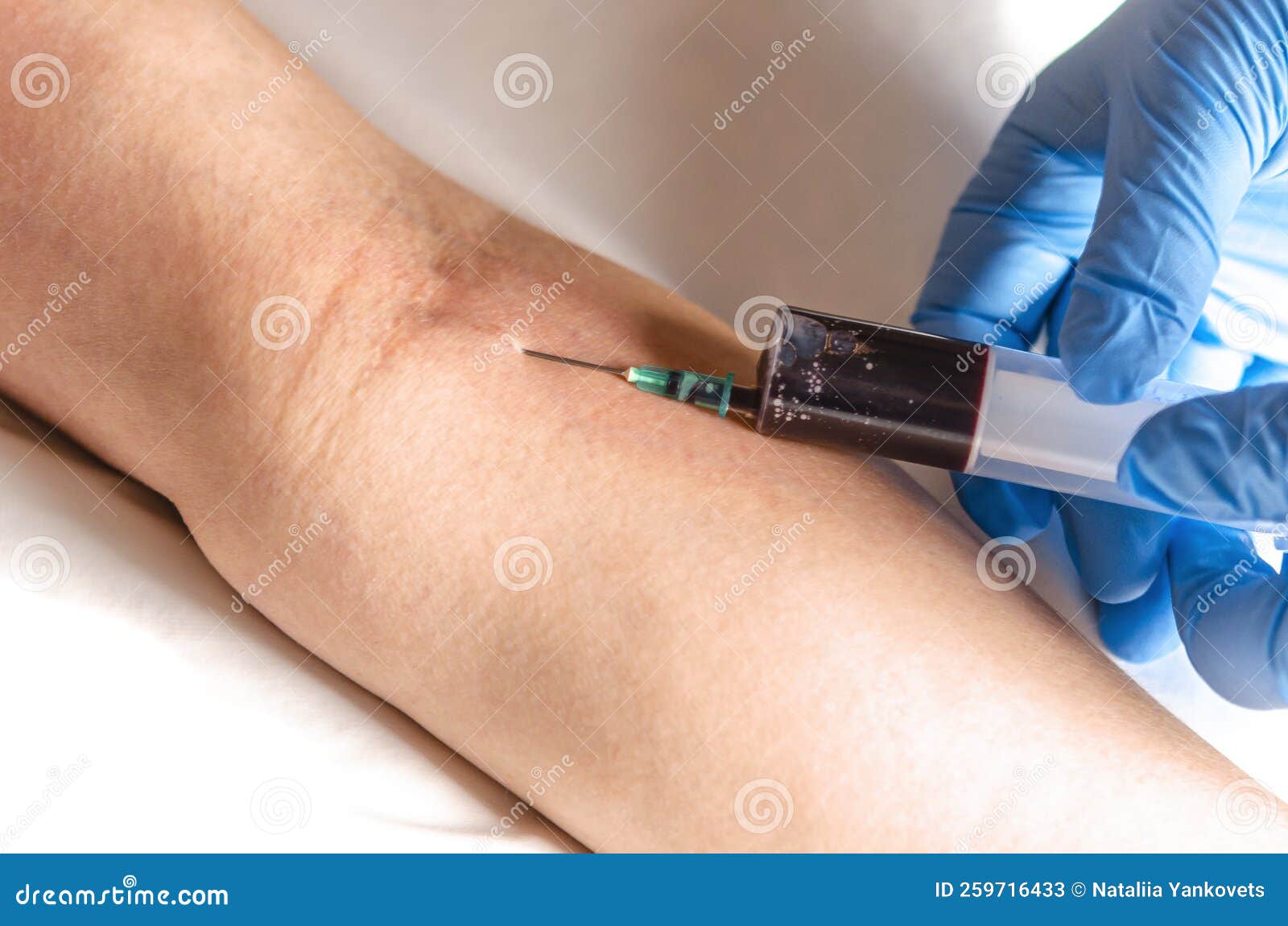 Hospital. Venous Blood Sampling for Analysis in the Hospital. Health ...