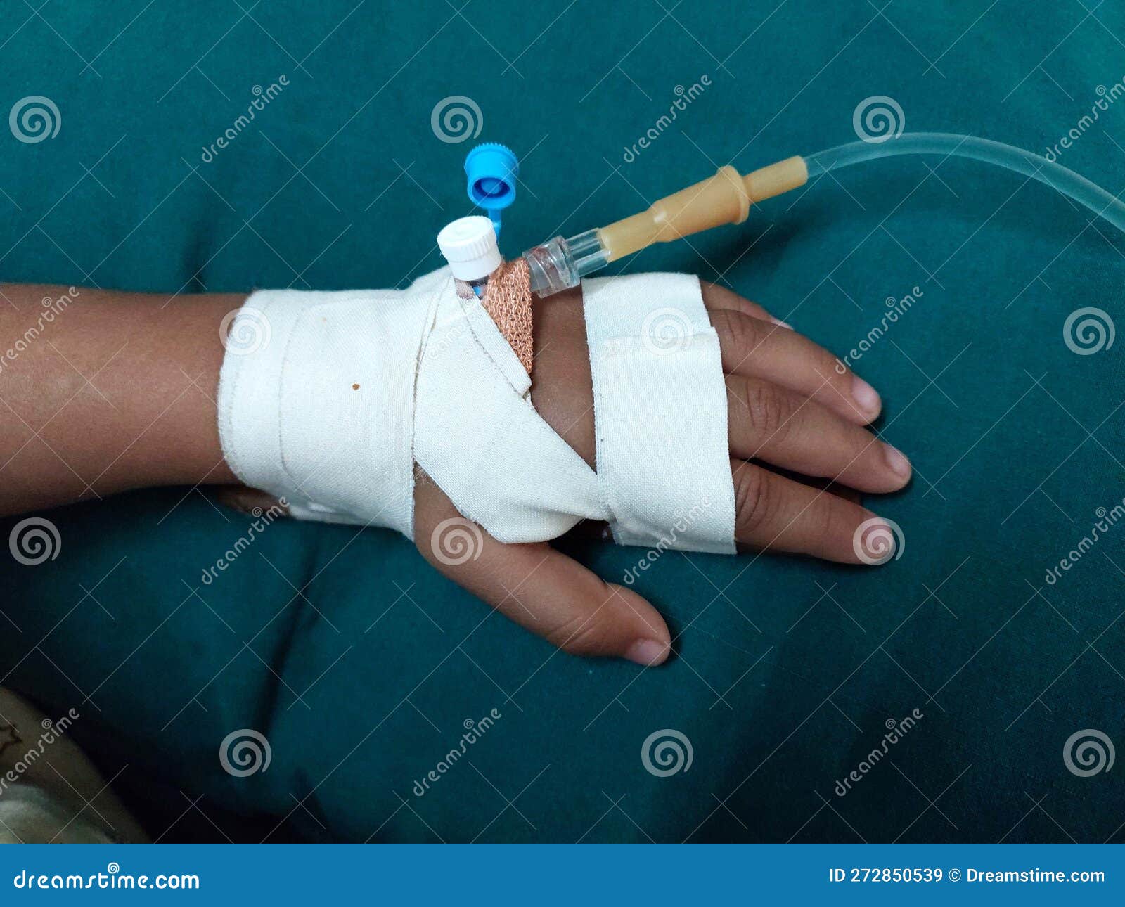 Hospitalize Patient Hand with Iv Set and Plaster Stock Image - Image of ...