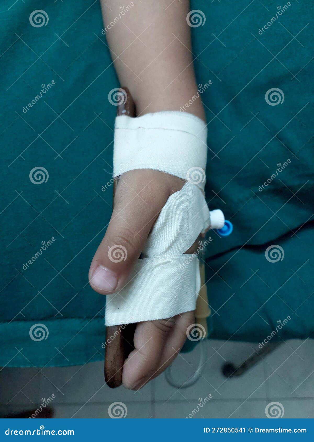 Hospitalize Patient Hand with Iv Set and Plaster Stock Image - Image of ...