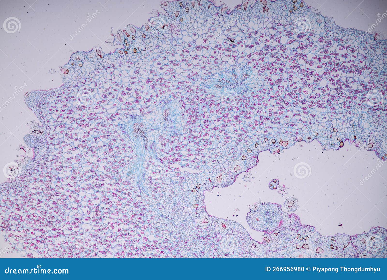 Host Cells with Spores Mold are Inside Wood Under the Microscope. Stock ...