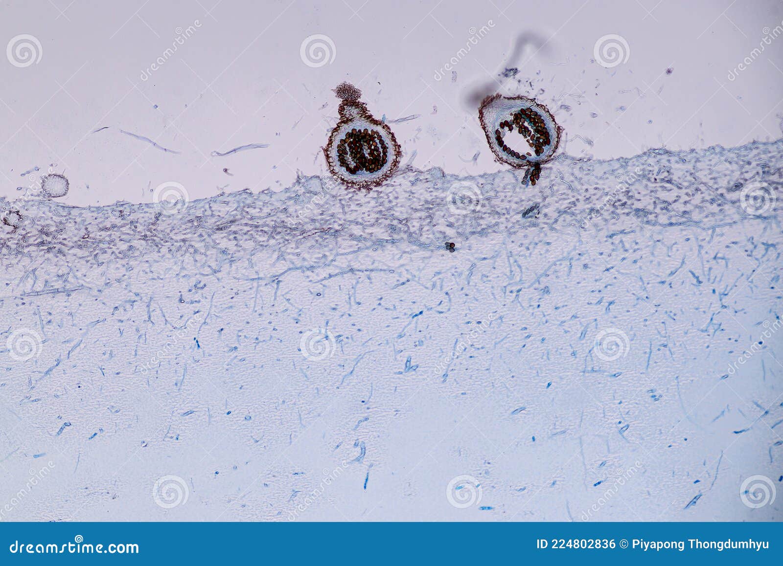 Inside Microscope View At Histology Glass Slide Stock Photo ...