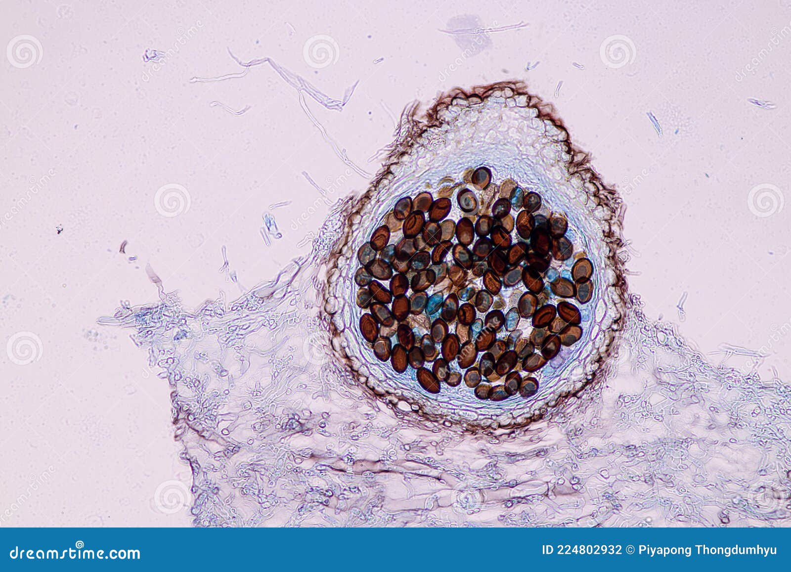 Inside Microscope View At Histology Glass Slide Stock Photo ...