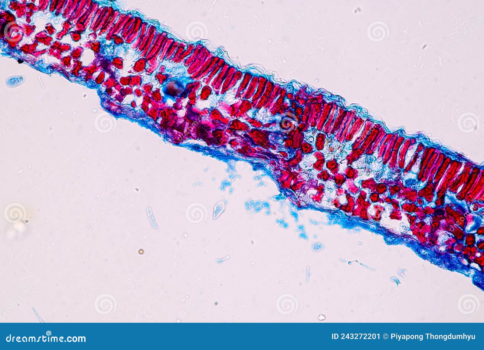 Host Cells with Spores Mold are Inside Wood Under the Microscope Stock ...