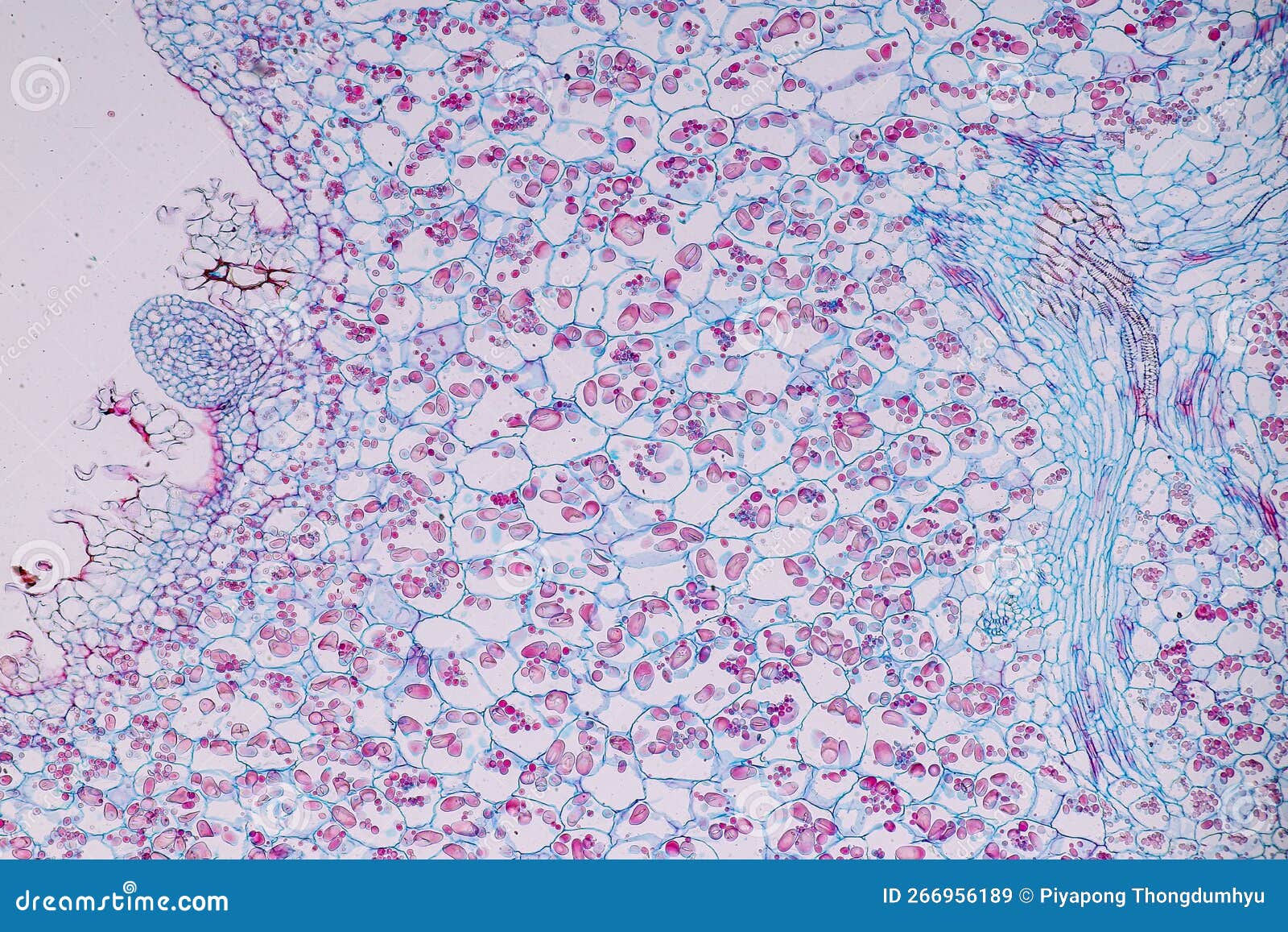 Host Cells with Spores Mold are Inside Wood Under the Microscope. Stock ...