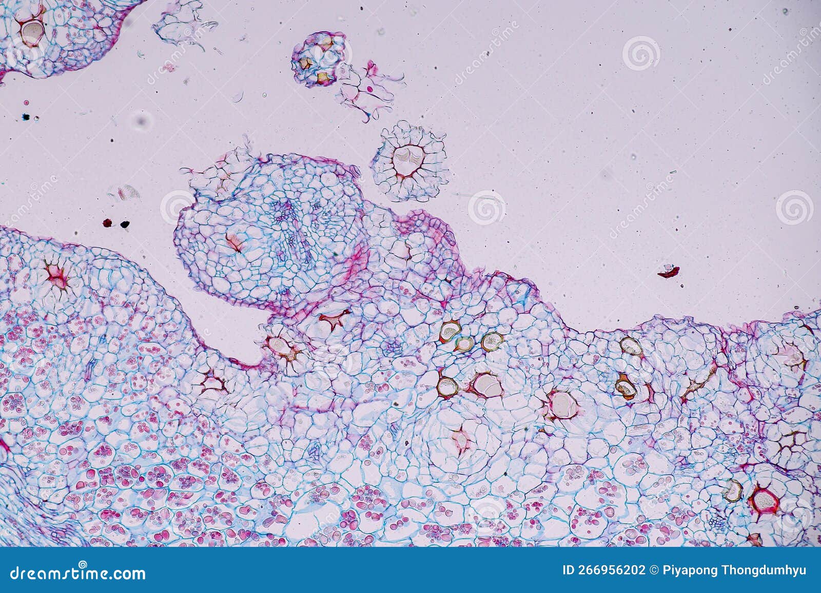 Host Cells with Spores Mold are Inside Wood Under the Microscope. Stock ...