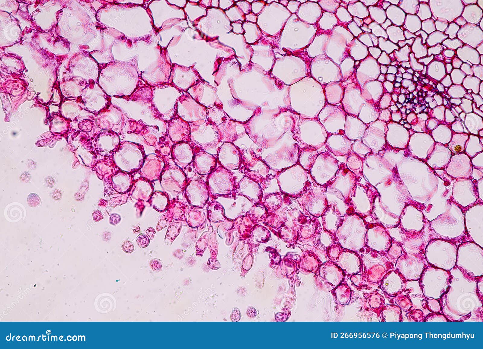Host Cells with Spores Mold are Inside Wood Under the Microscope. Stock ...