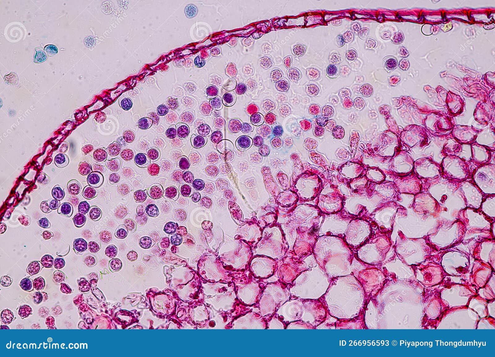 Host Cells with Spores Mold are Inside Wood Under the Microscope. Stock ...
