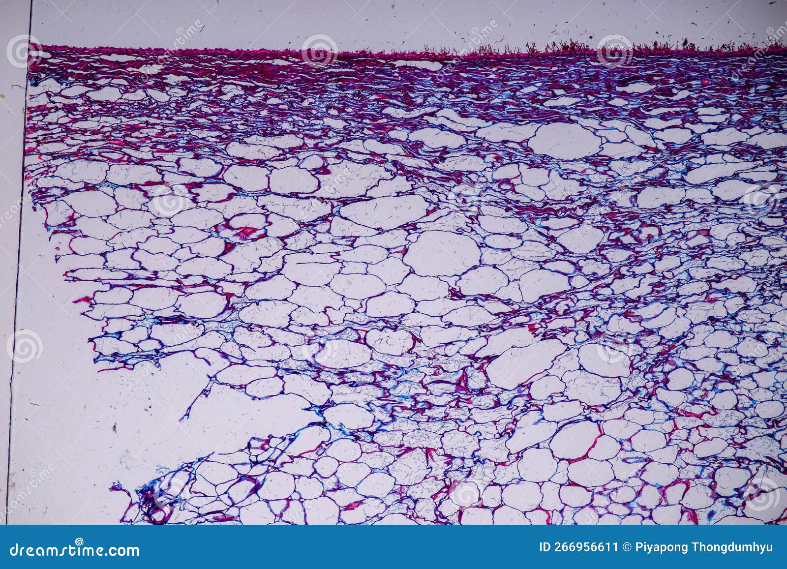 Host Cells with Spores Mold are Inside Wood Under the Microscope. Stock ...