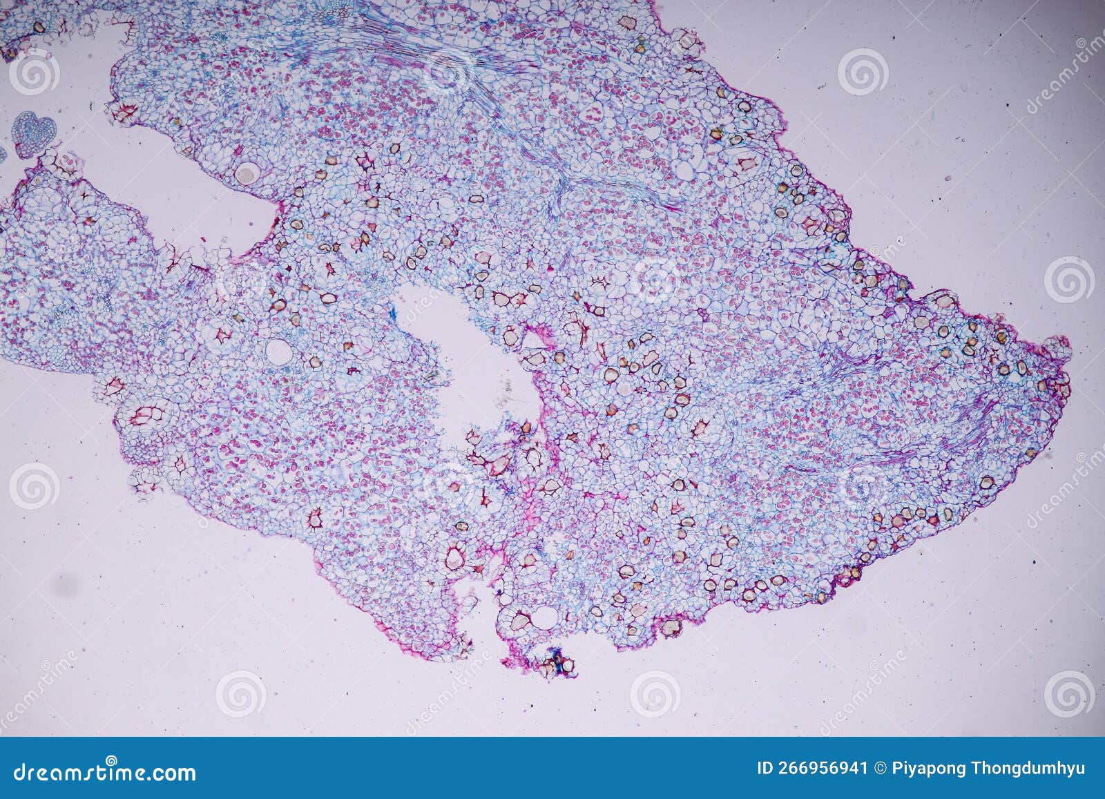 Host Cells with Spores Mold are Inside Wood Under the Microscope. Stock ...