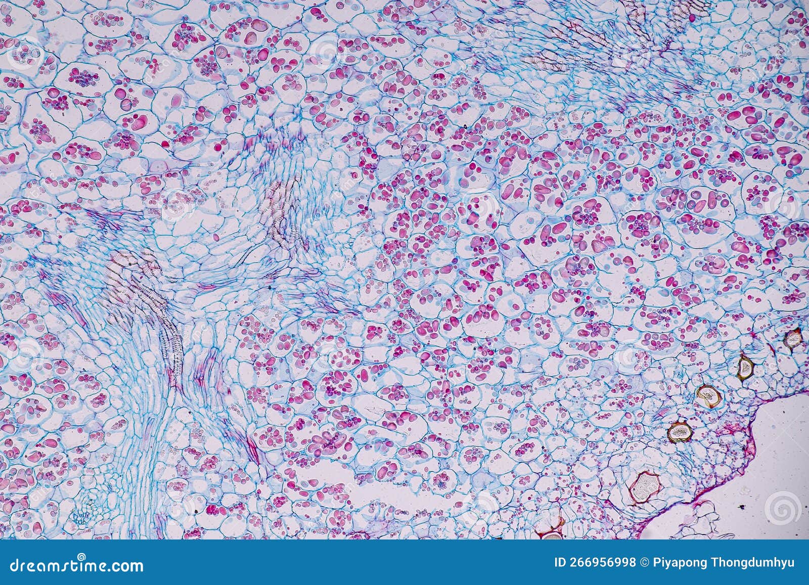 Host Cells with Spores Mold are Inside Wood Under the Microscope. Stock ...